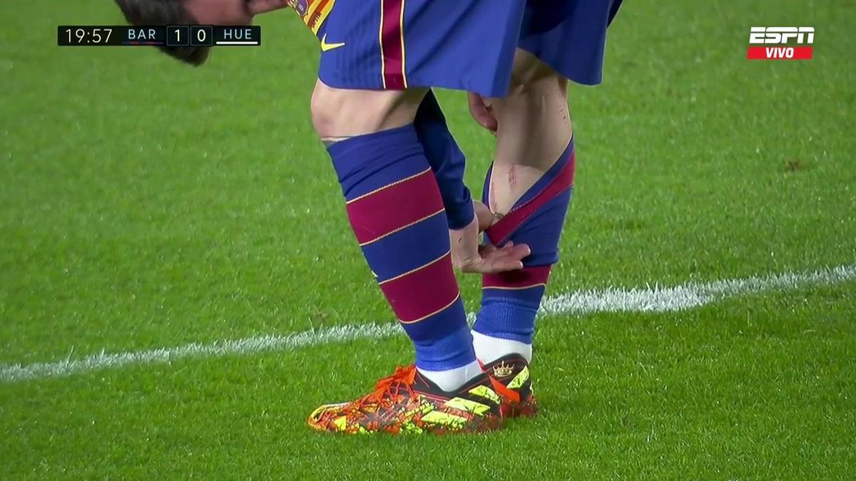 Así quedó le pierna de Messi tras la entrada de Pulido - Sport