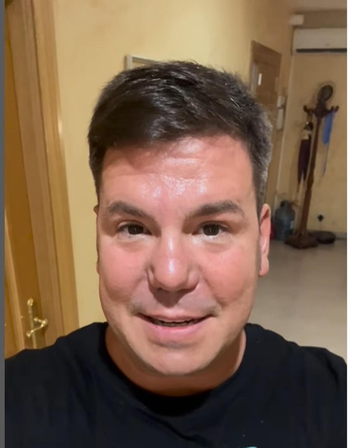 La operación estética a la que se ha sometido Lucas, de "Andy y Lucas ...