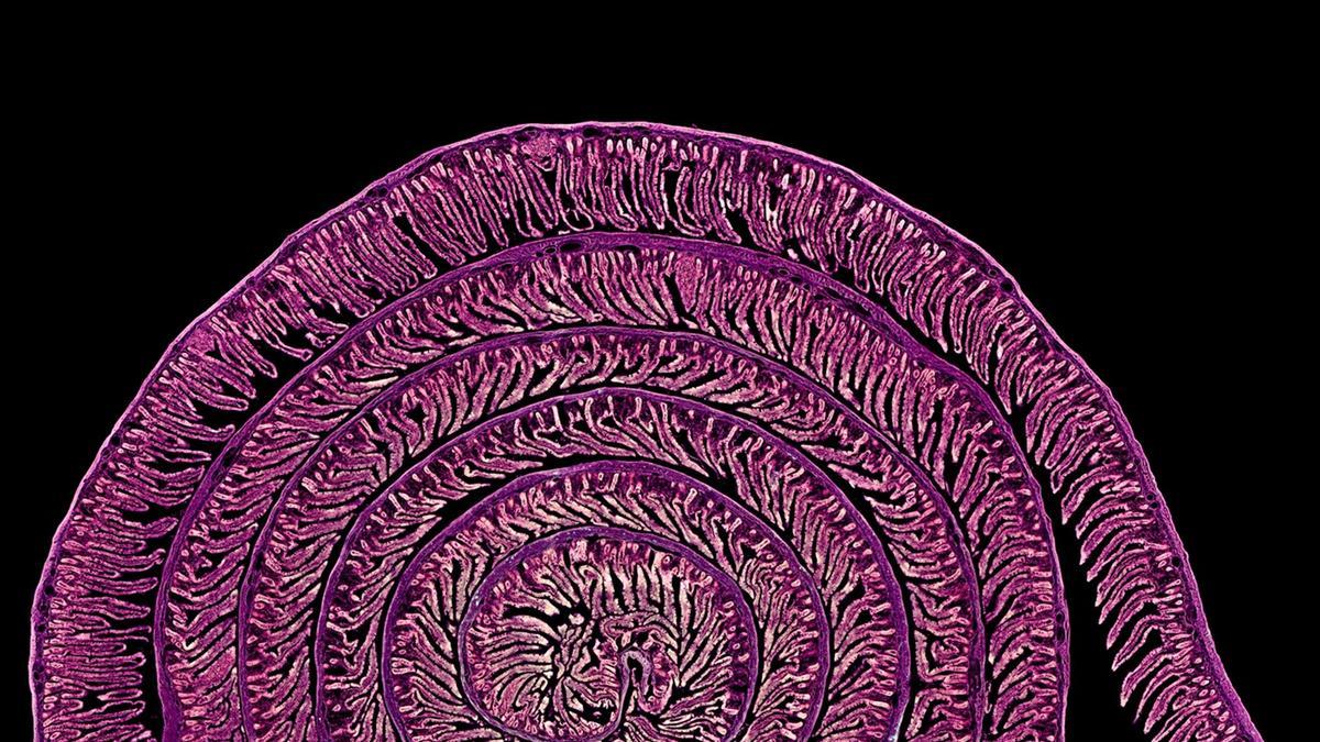 'Uzumaki' fotografía realizada en un hospital de Toledo galardonada en ...