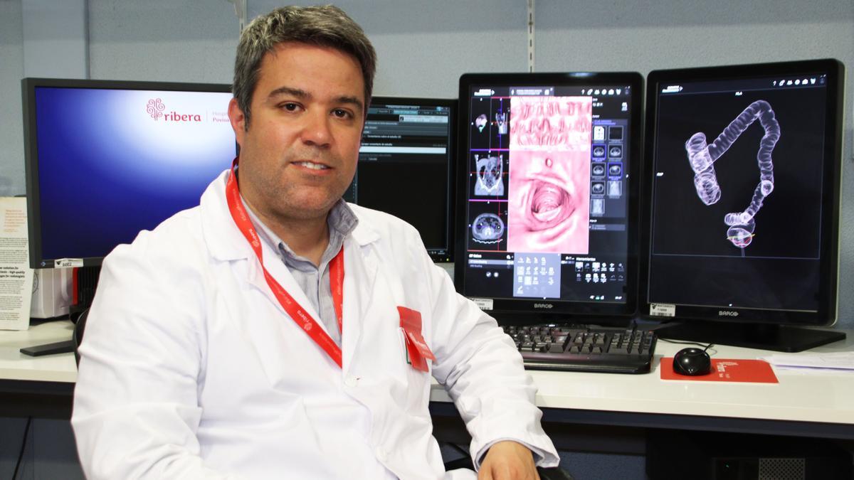 El Anillo Radiológico de Ribera integra ocho hospitales del grupo con los mejores especialistas ...