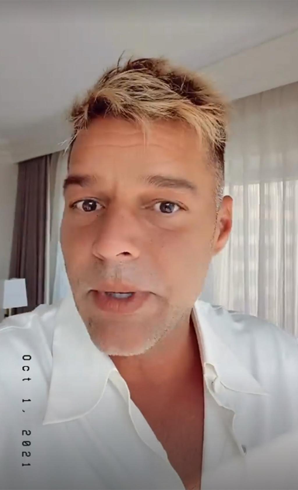 Ricky Martin da la cara por su cara: la culpa fue de un suero - Cuore