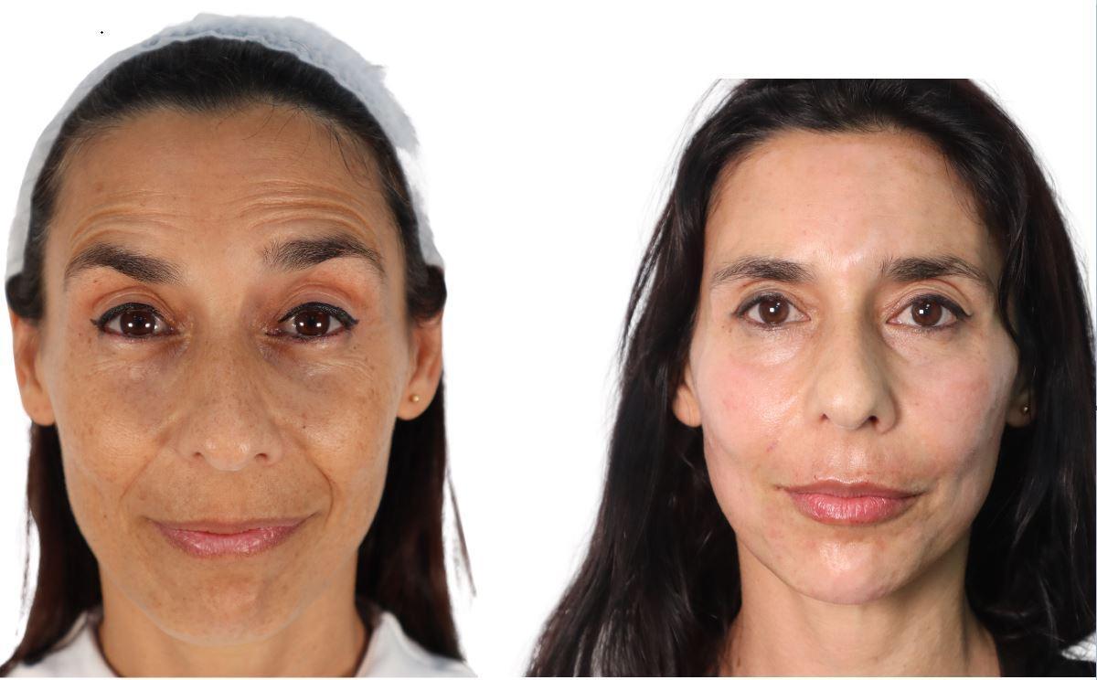 Clínica Dra. Yasmin Al Adib en Ibiza: armonización facial y láser para ...