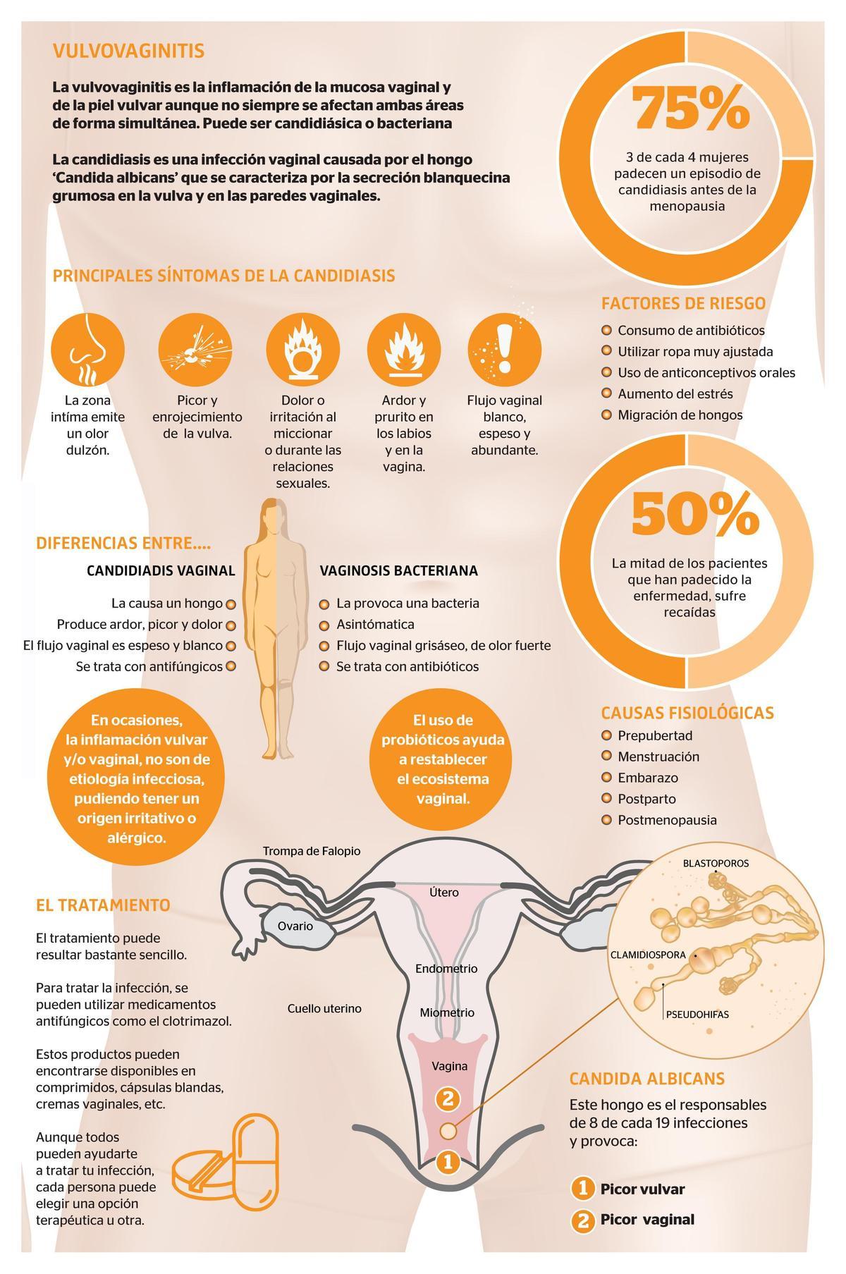 Candidiasis Vaginal