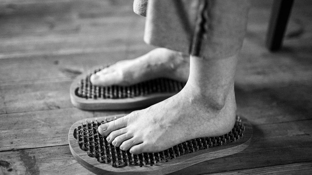 ¿Cómo prevenir la queratolisis punctata, provocada por una bacteria y ...