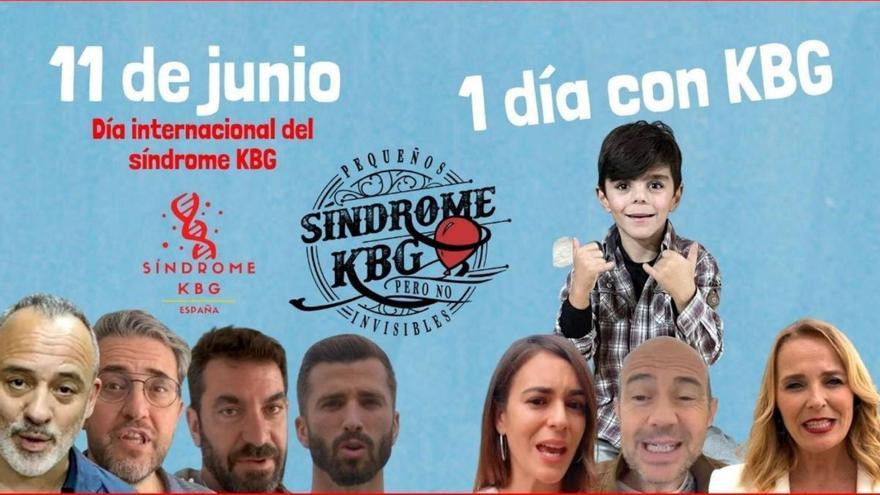 Rostros famosos para dar visibilidad al Síndrome KBG, con menos de cien casos en España