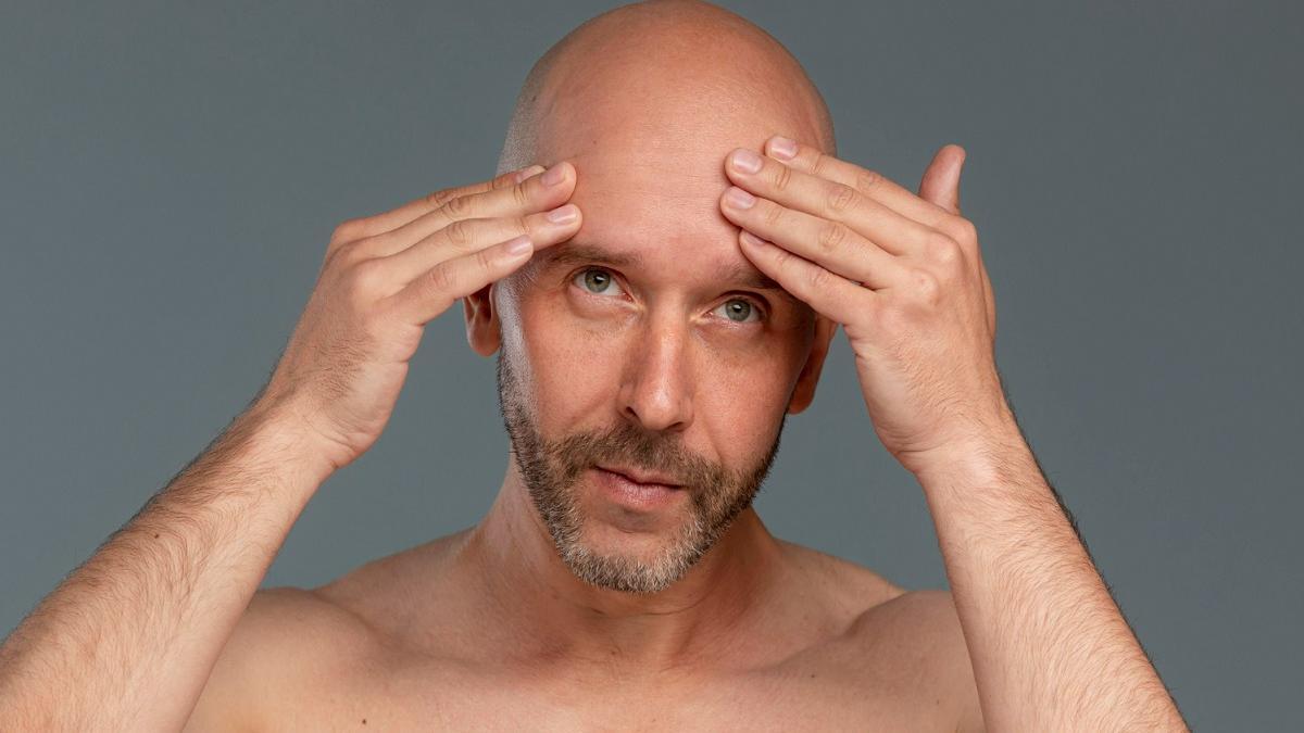 Los calvos también necesitan champú: cómo cuidar y proteger el cuero ...