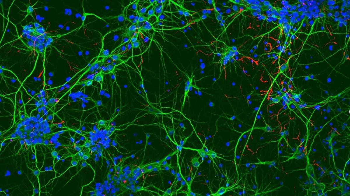 Esperanza en lesión medular: un hidrogel permite cultivar células ...