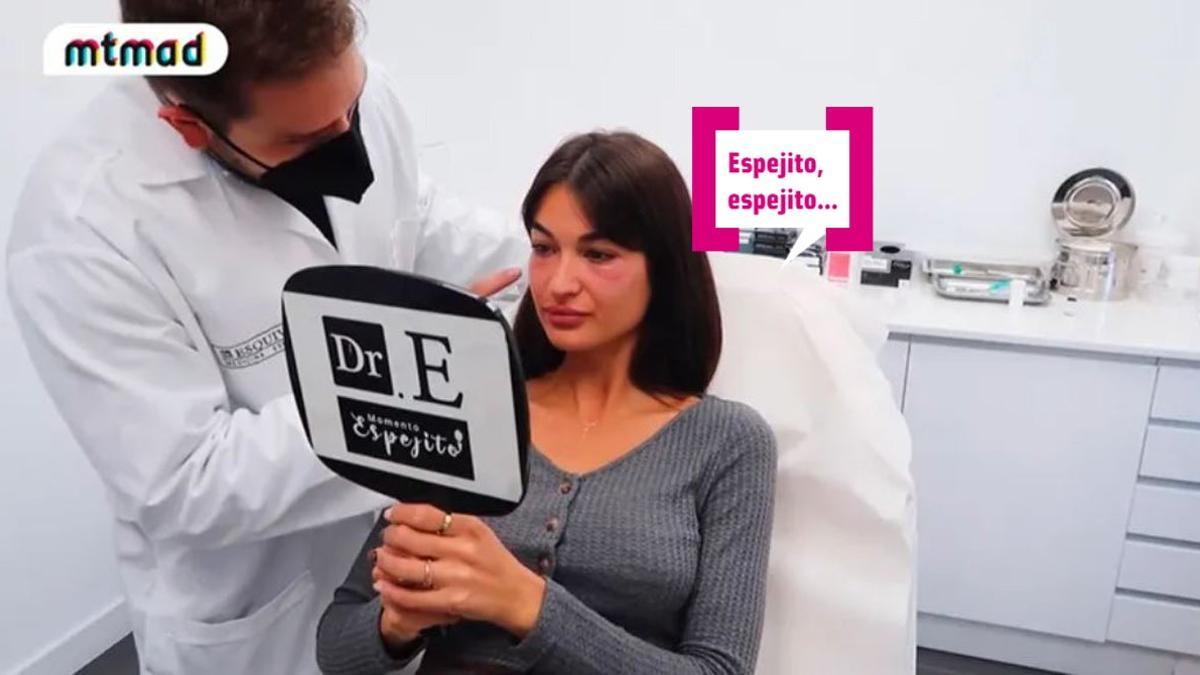 El último retoque estético de Estela Grande sale mal - Cuore