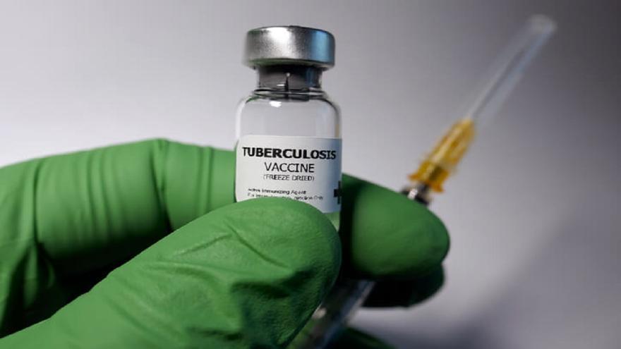La vacuna contra la tuberculosis mejora la inmunidad contra otras ...