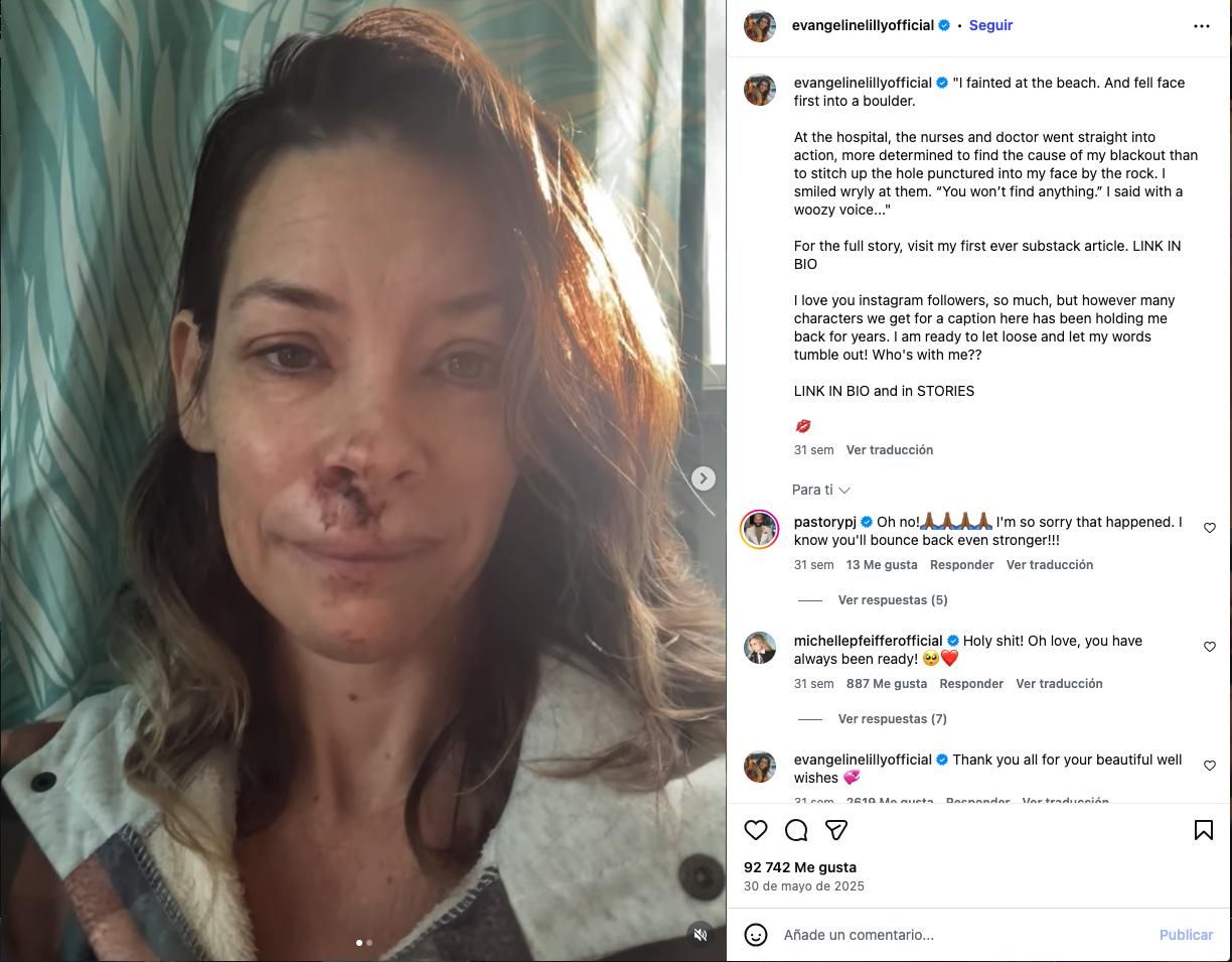 EVANGELINE LILLY DAÑO CEREBRAL Evangeline Lilly, la mítica actriz de ...