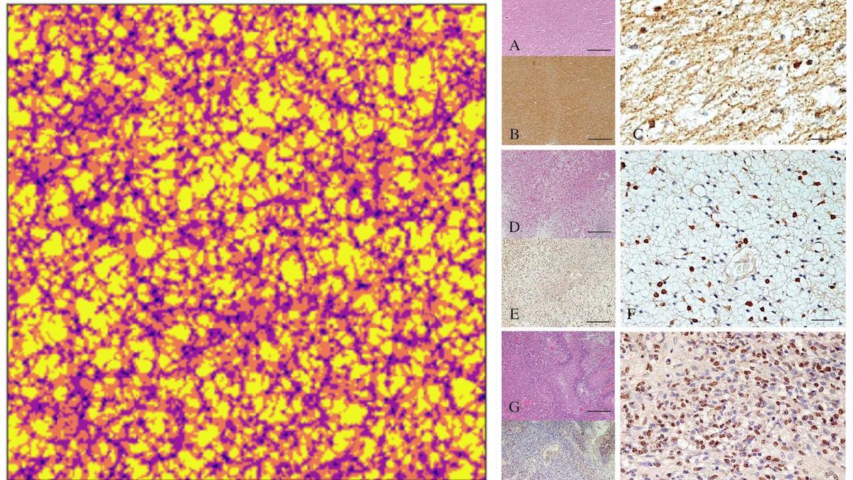 GAVETA ASTROFÍSICA: Un Universo en nuestro cerebro