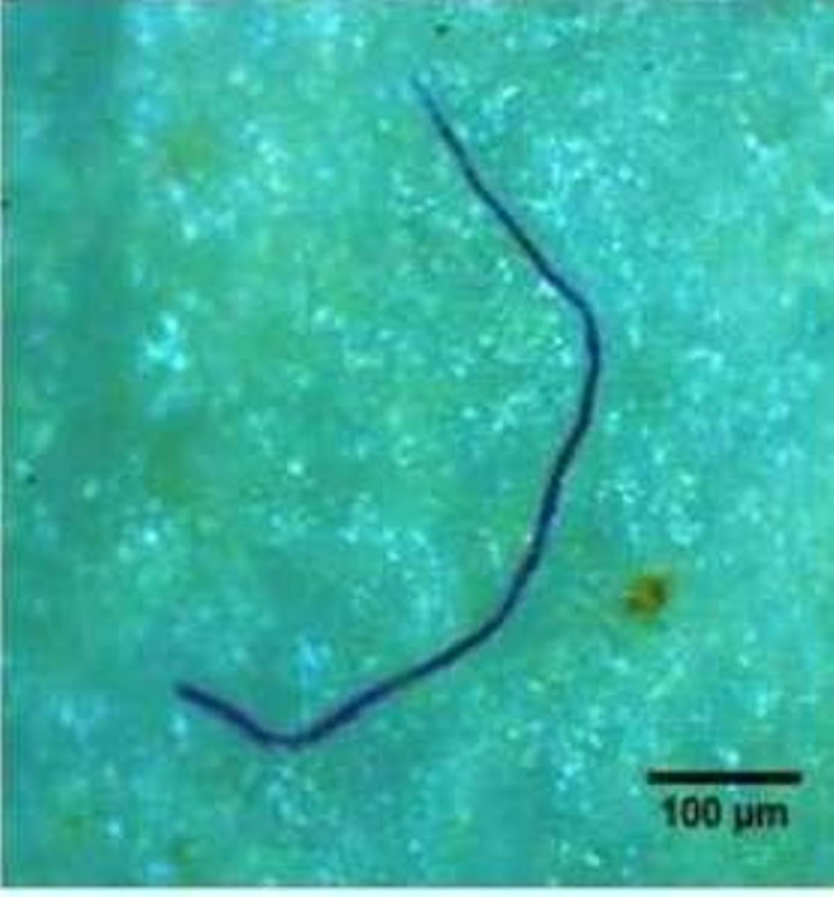 Detectan microplásticos en mejillones de roca de la ría de Vigo