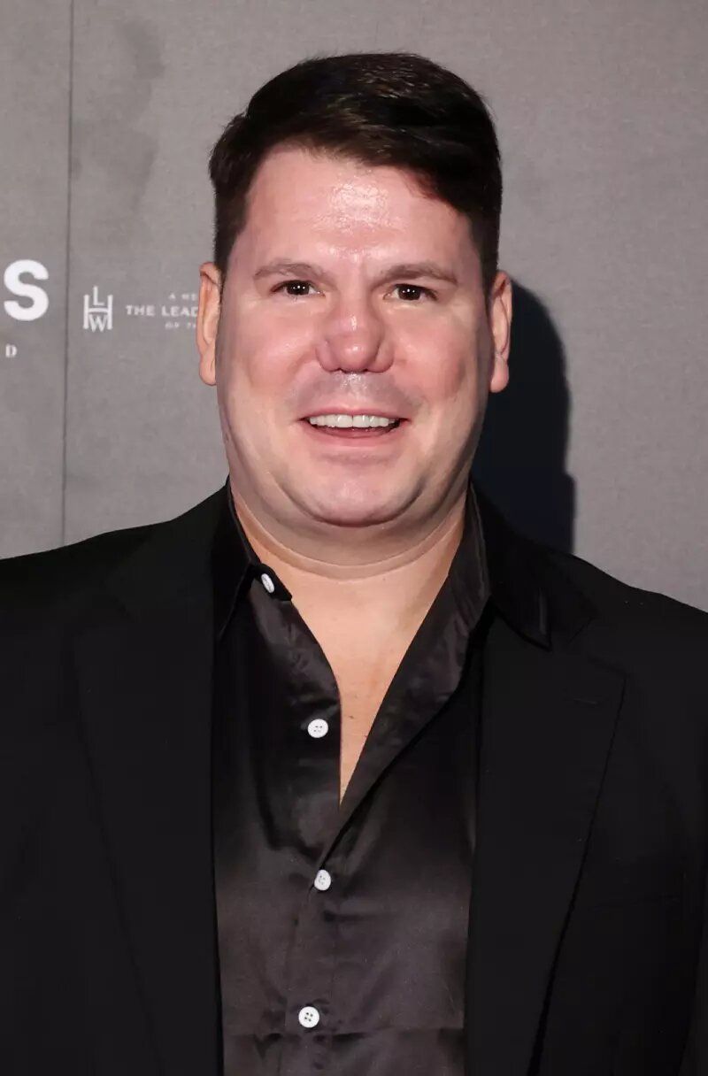 Qué se ha hecho Lucas ('Andy y Lucas') en su nueva nariz: un ...