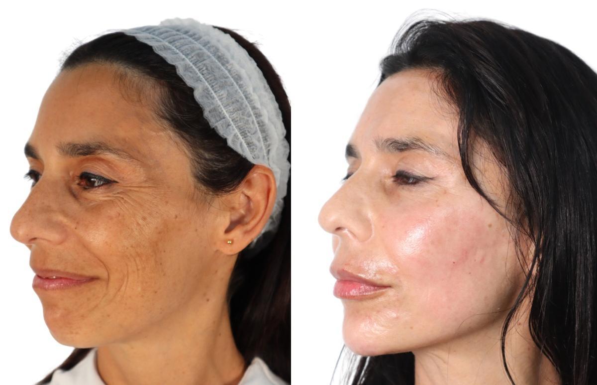 Clínica Dra. Yasmin Al Adib en Ibiza: armonización facial y láser para ...
