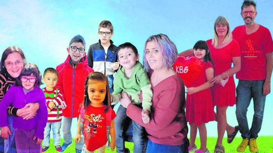 KBG, una enfermedad rara entre las raras