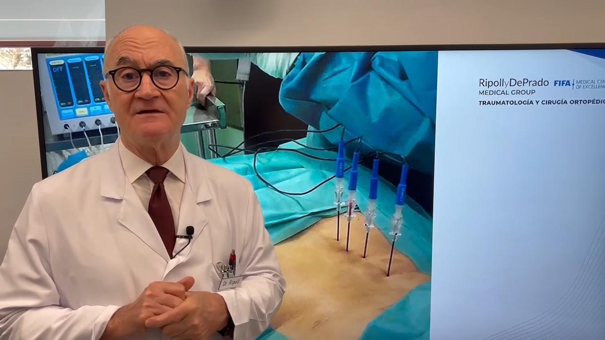 El doctor Pedro Ripoll valora el tratamiento conservador de la pubalgia ...