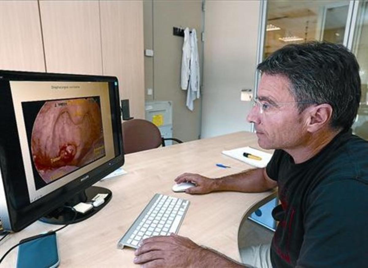 Los Médicos Confirman Que El Sexo Oral Puede Causar Cáncer El Periódico