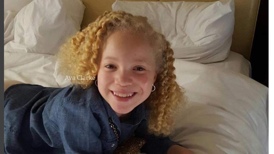 Ava Clarke, la niña negra albina que despunta en la moda
