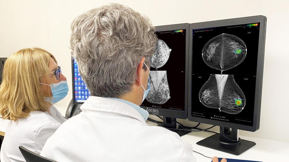 Un 'software' de IA evita falsos negativos en cáncer de mama con una ...