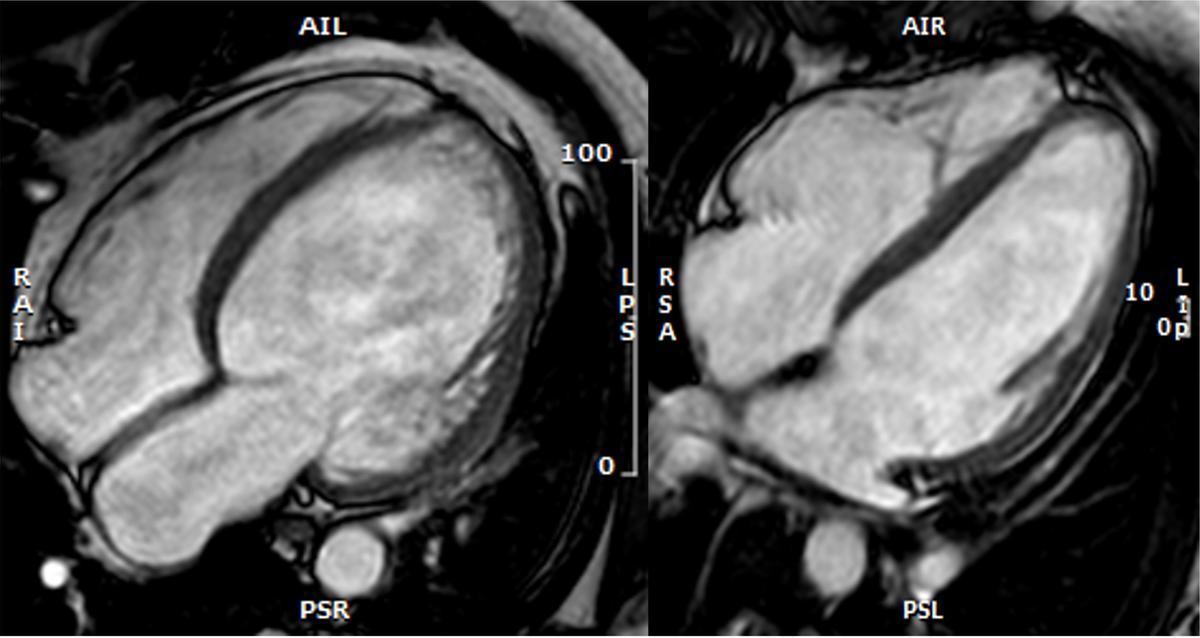 Medicina VALENCIA: La Fe participa en un estudio que identifica por primera vez el riesgo de ...