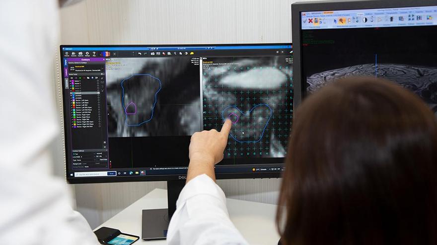 Cáncer de próstata: la biopsia por fusión detecta el 96% de los casos