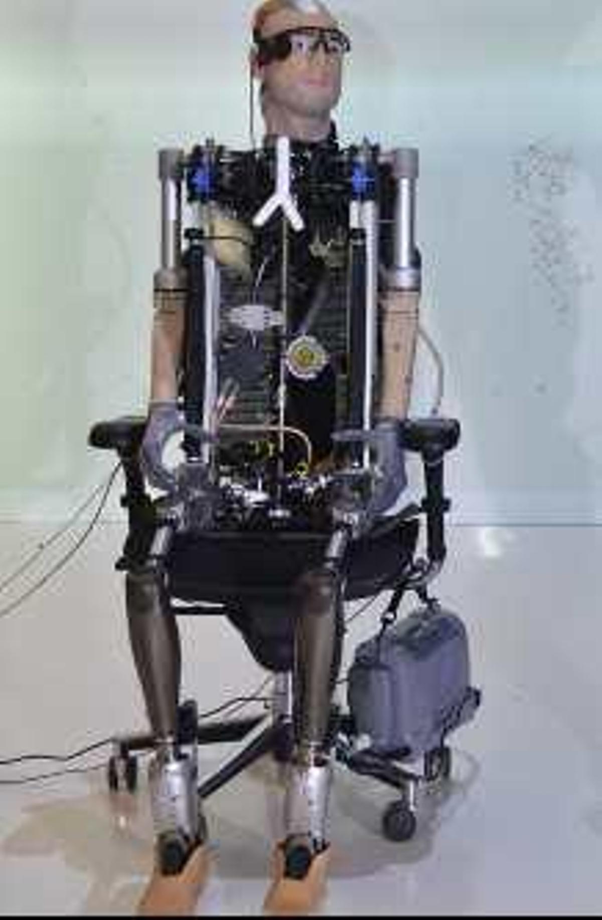 Rex, el hombre biónico