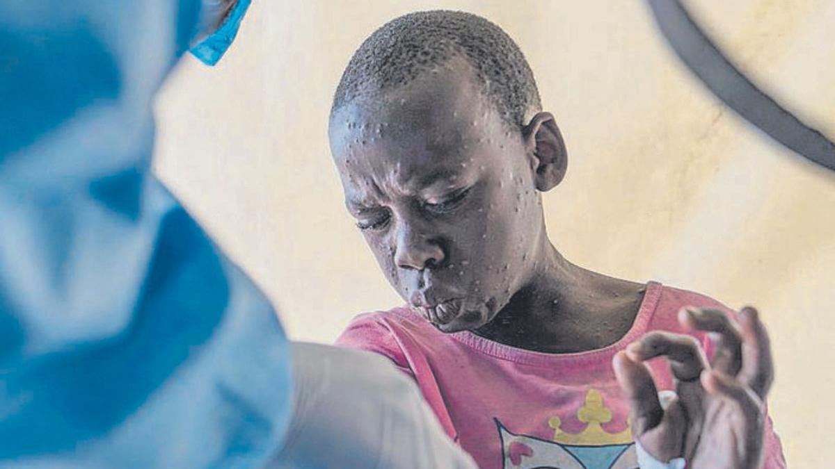 Resposta més feble a noves pandèmies