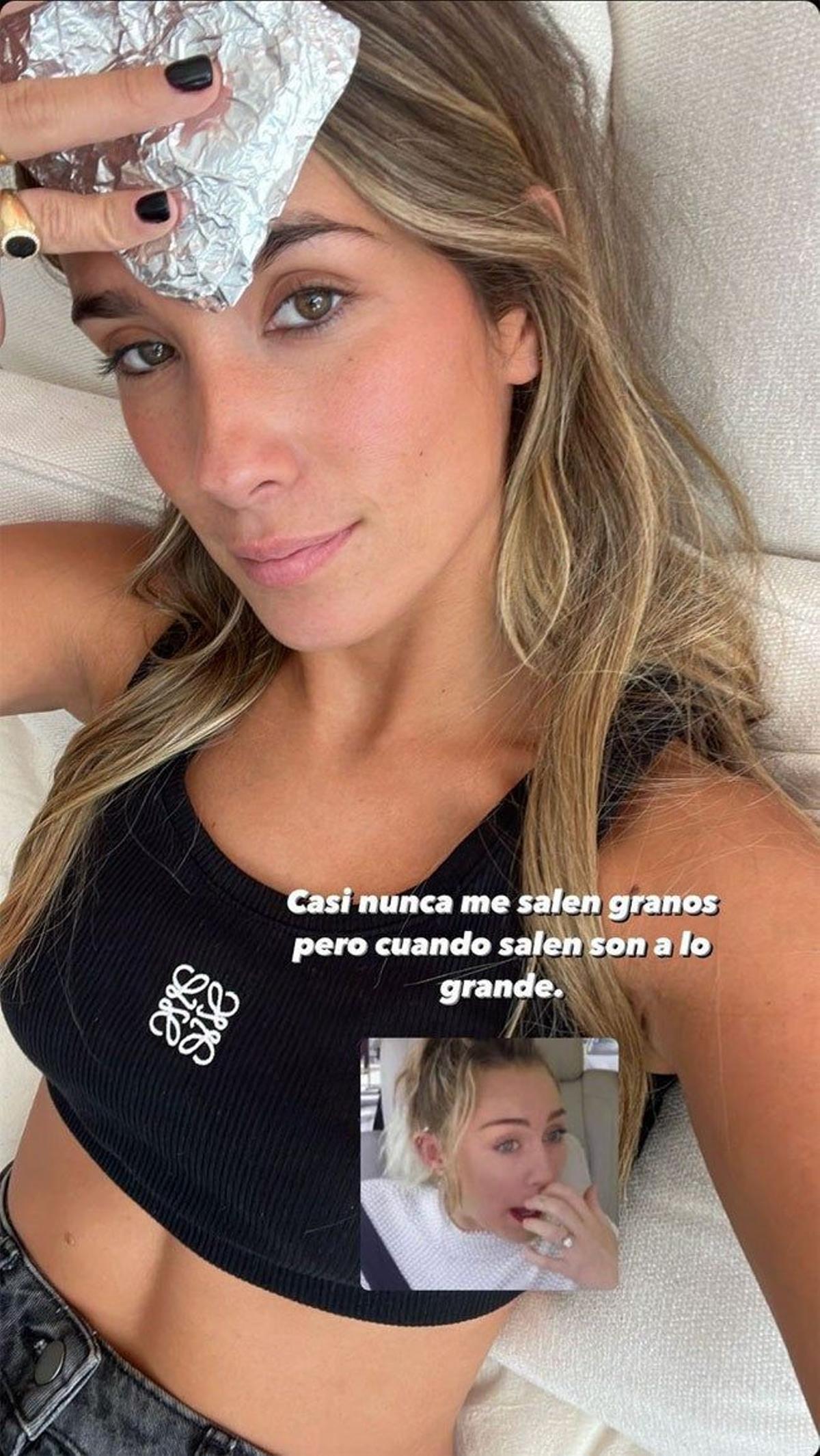 El grano en la frente de María Pombo en la gala de los Forbes Best ...