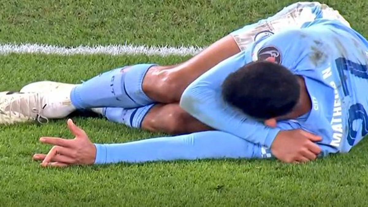 La dura imagen del dedo roto de Matheus Nunes, del Manchester City