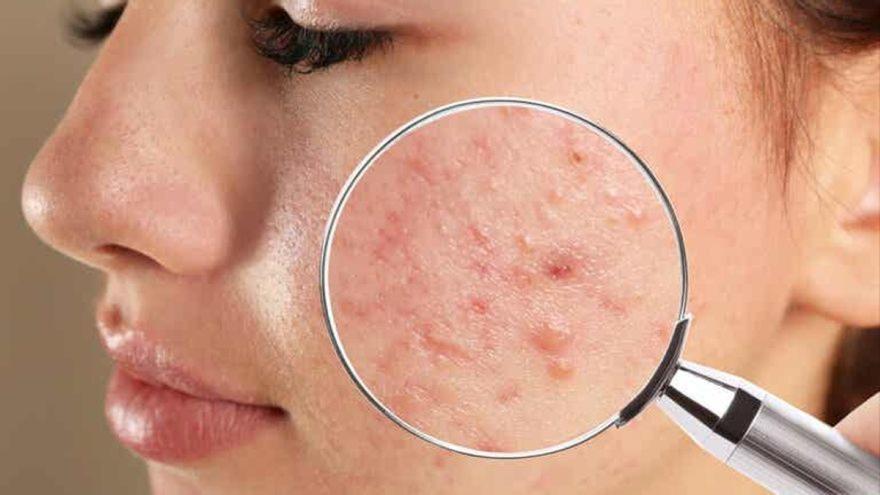Enfermedades en la piel | Estas son las afecciones más comunes de la ...