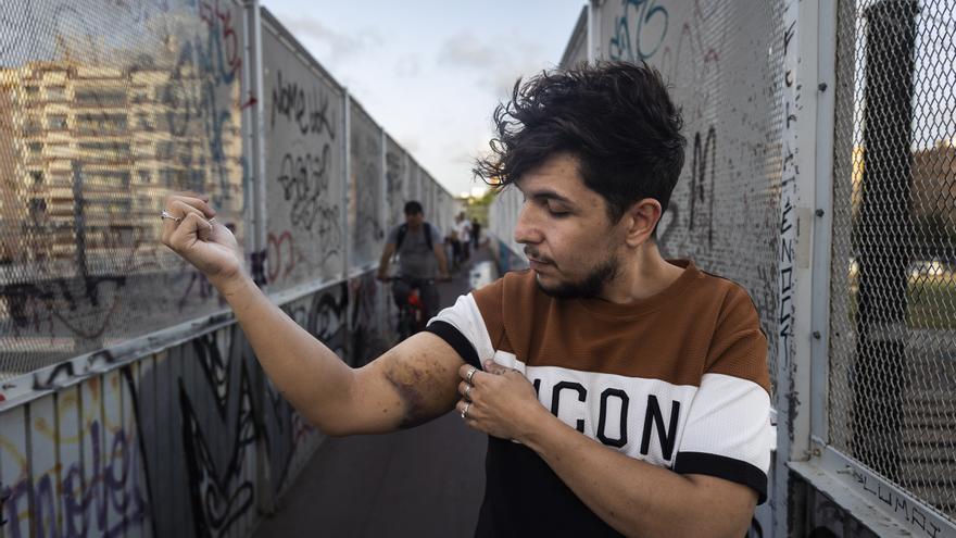 Un joven denuncia una agresión homófoba a manos de seis personas en ...