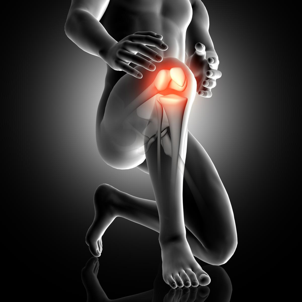 Artrosis y otras lesiones de la rodilla que pueden detectarse con una ...