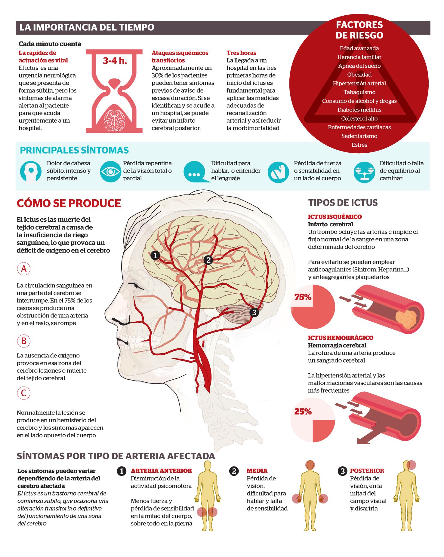 El ictus, una lucha a contrarreloj