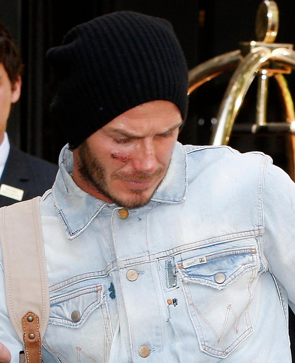 David Beckham con muletas - Cuore