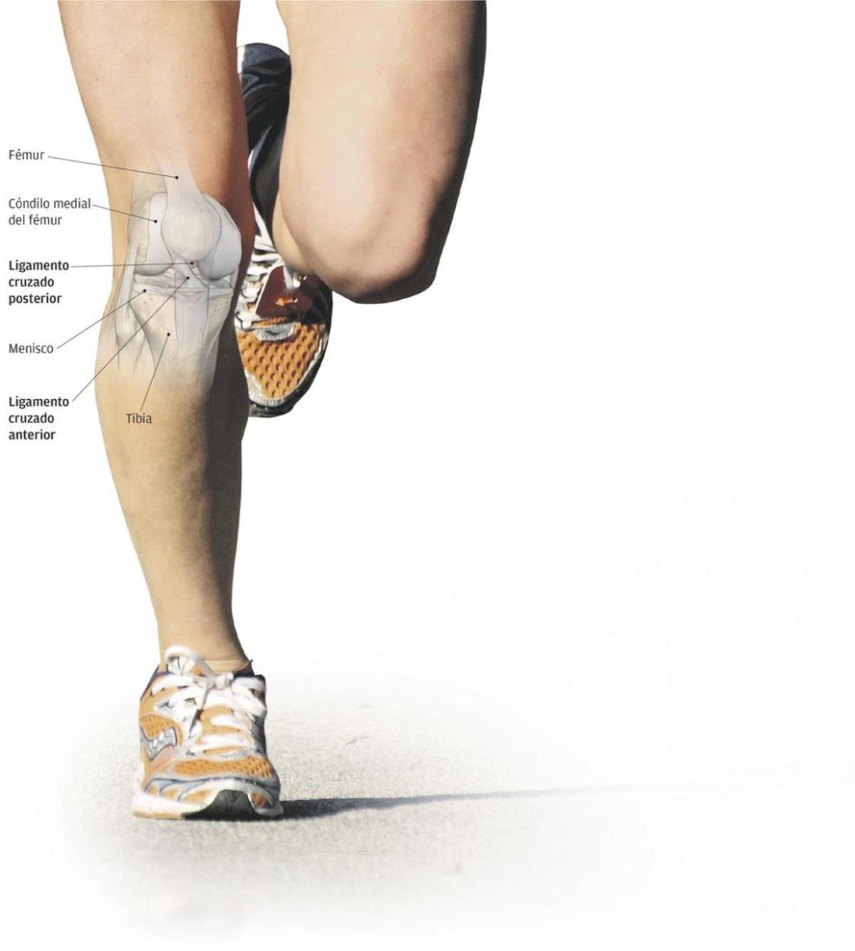 Lesiones de rodilla, pesadilla deportiva