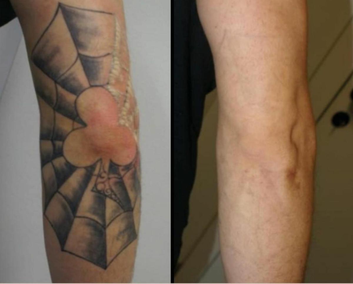 Marisa Tirado amplía su unidad láser con equipos de vanguardia