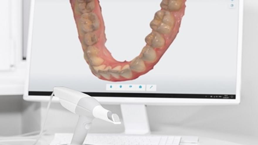El flujo digital, un modelo a la vanguardia de la odontología - El Periódico Extremadura