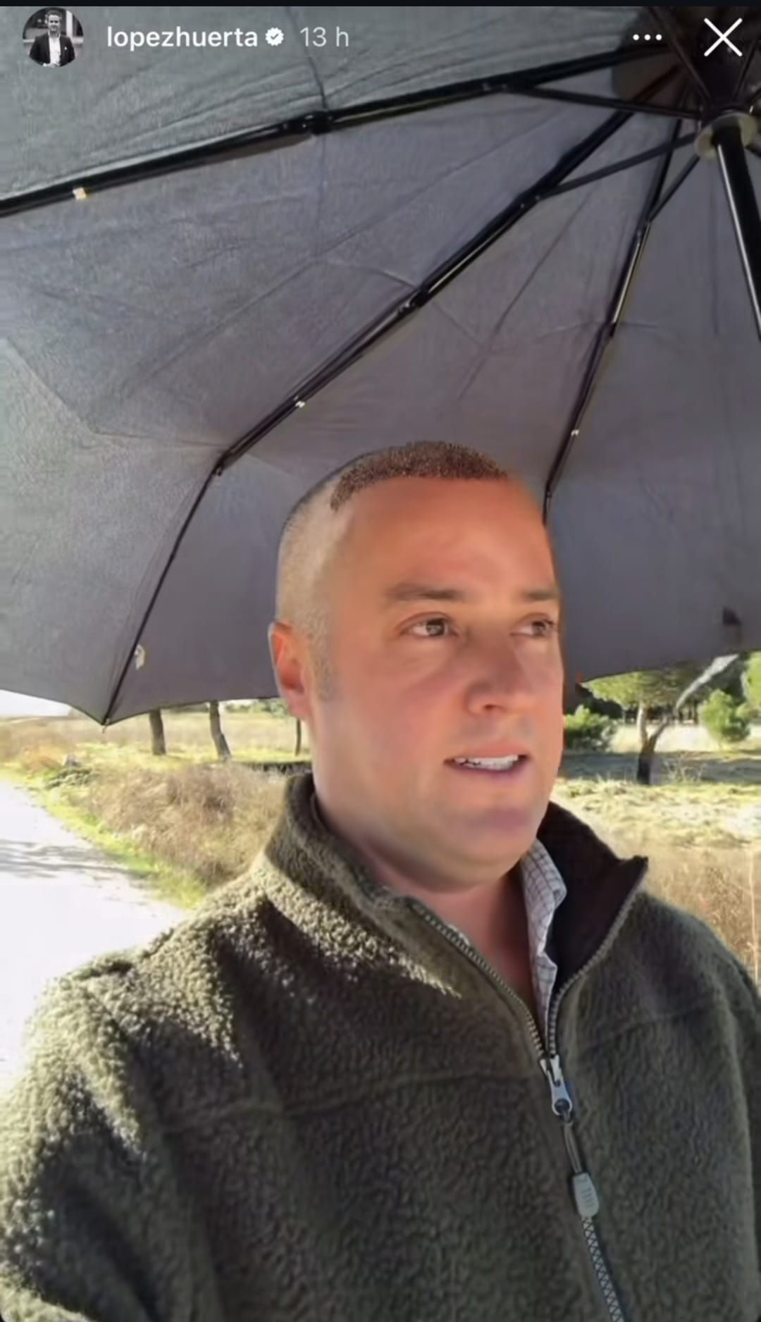 Álvaro López Huerta, marido de Lucía Pombo, cuenta la realidad de su injerto de pelo - Cuore