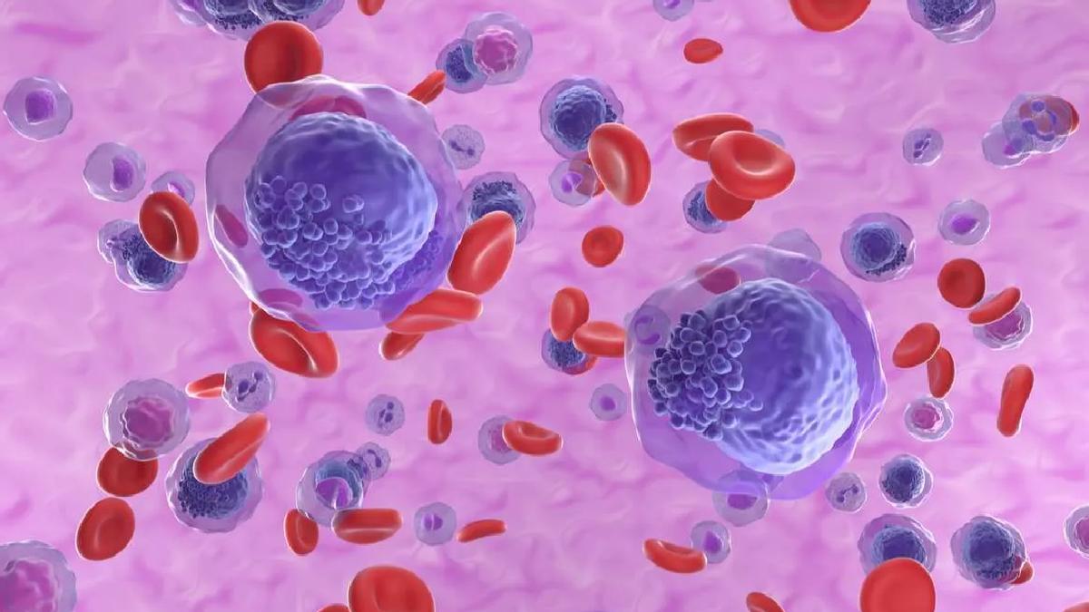 Leucemia en Canarias: Estos son los síntomas tempranos de la leucemia, el cáncer más frecuente ...