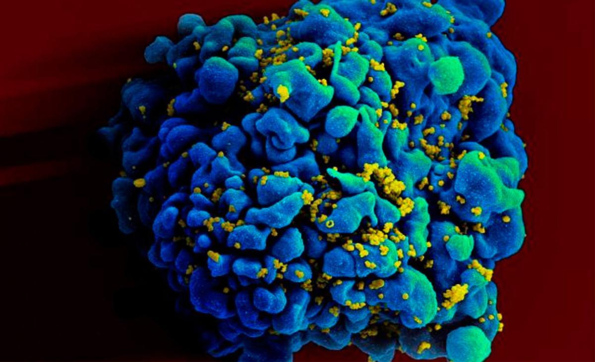 Chapare, el nuevo virus letal que enciende las alarmas