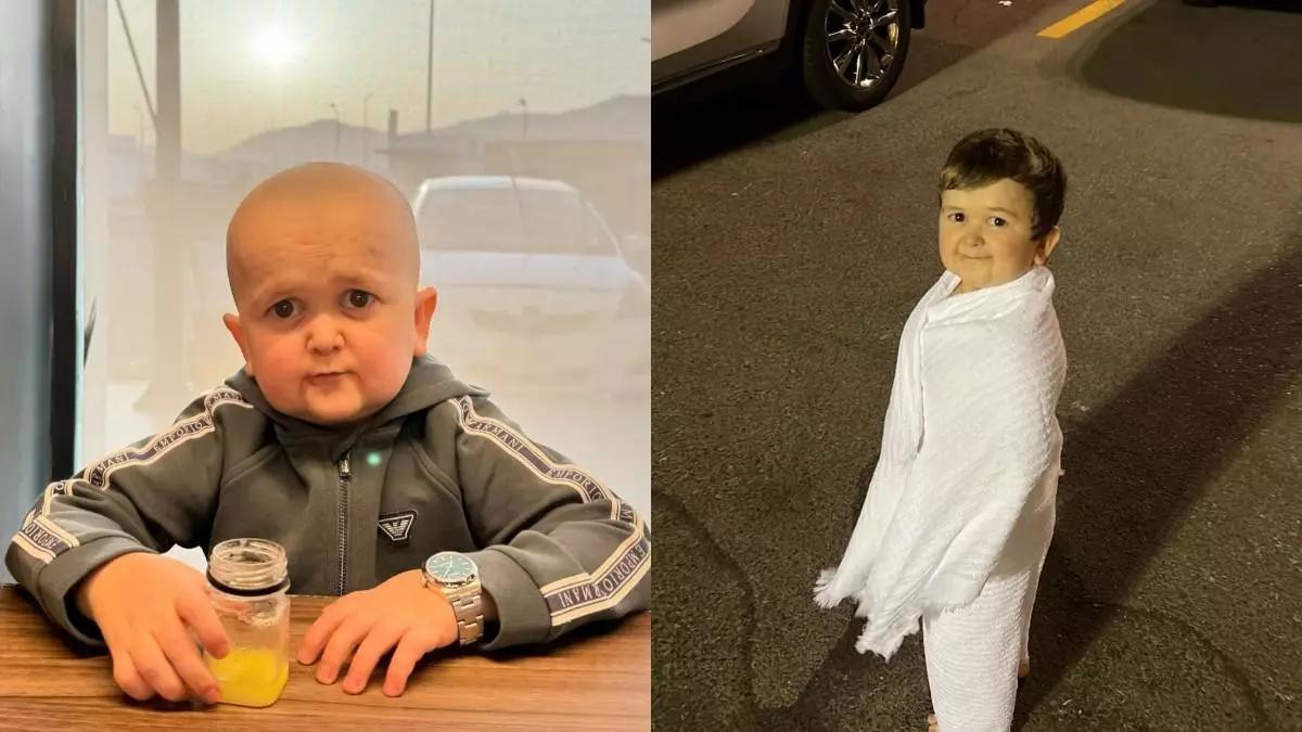 El cambio físico del popular influencer Hasbulla que arrasa en redes