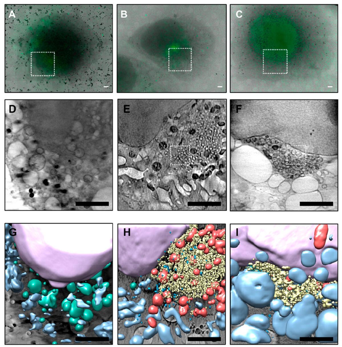 La prueba en 3D de cómo el covid afecta a los pulmones