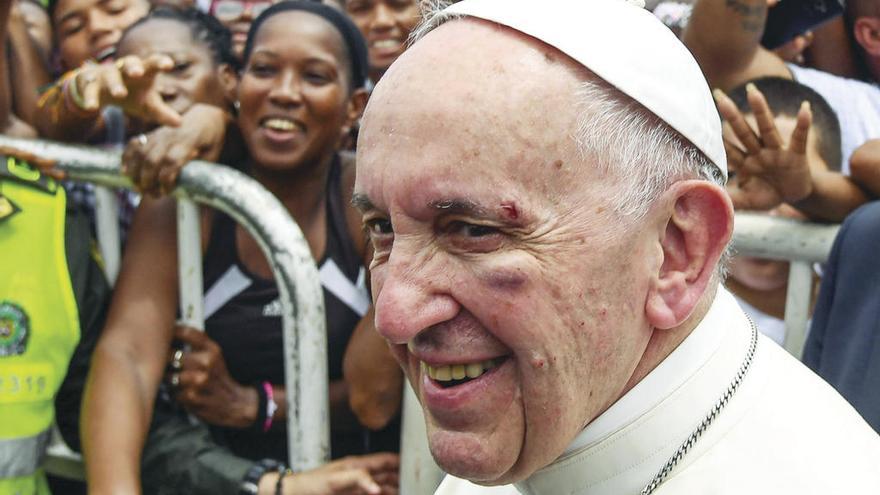 El moratón en la cara del Papa Francisco protagoniza su última jornada ...